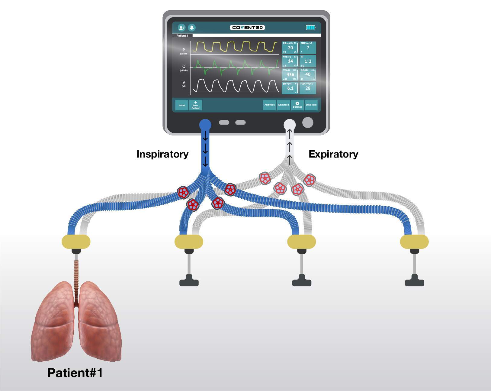 Quadrus Medical Vent App